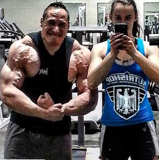 Muscle Growth Without Boundaries: Revisiting Gender Differences in ...